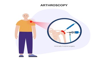 Shoulder Arthroscopy: A Minimally Invasive Solution for Shoulder ...
