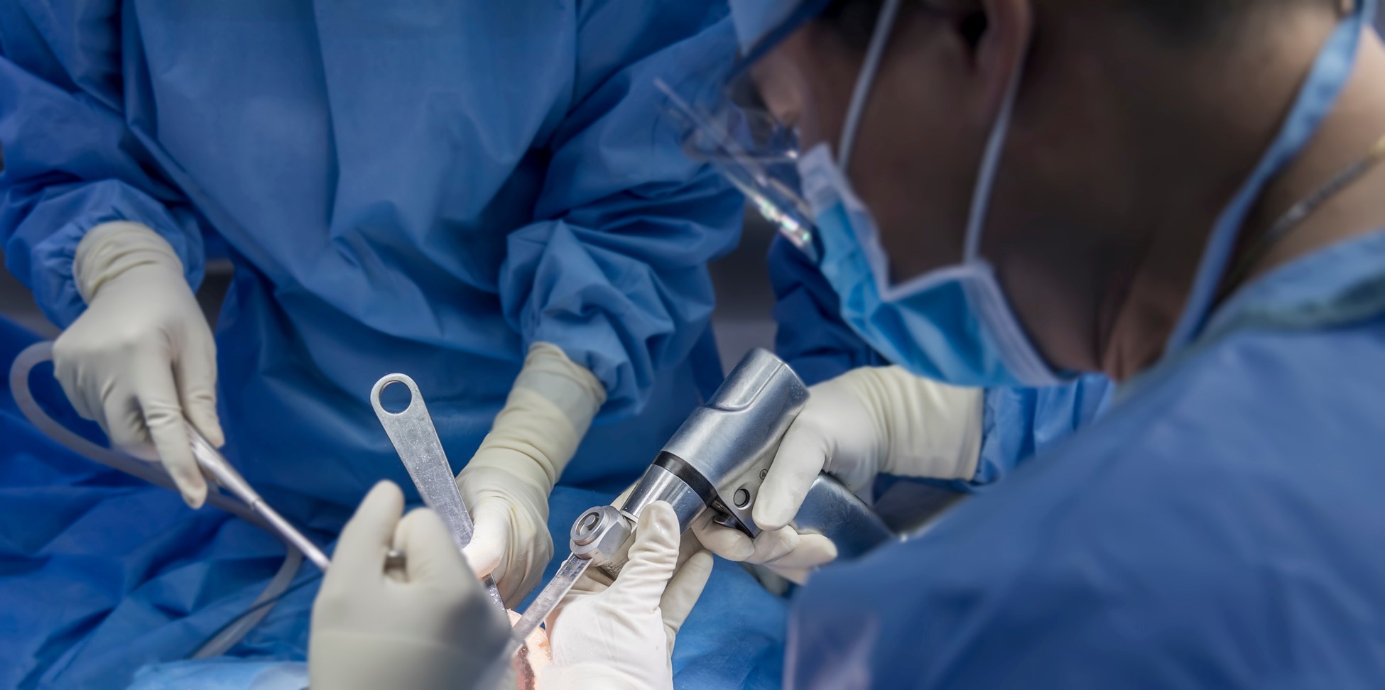 Knee Replacement Surgery: The Ultimate Solution for Severe Knee Pain ...